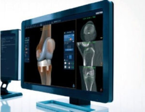 Sectra Orthopaedic Solutions - Medical Imaging Equipment
